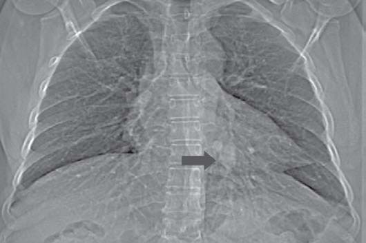 Oman Medical Journal-Archive