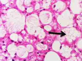 Oman Medical Journal-Archive