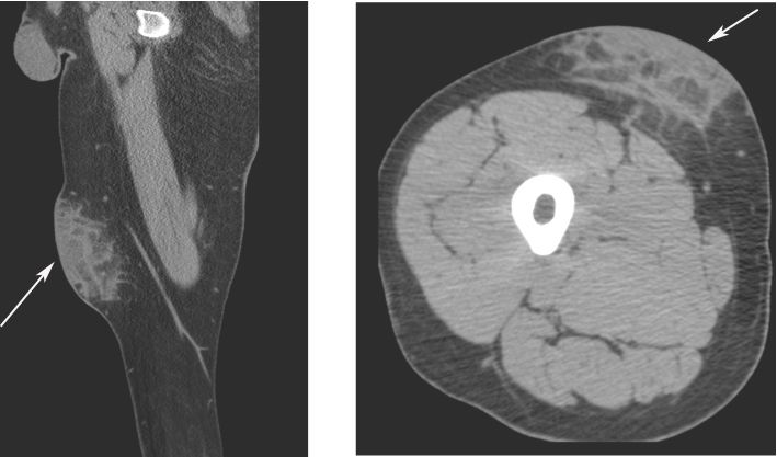 Oman Medical Journal-Archive