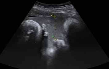 Oman Medical Journal-Archive